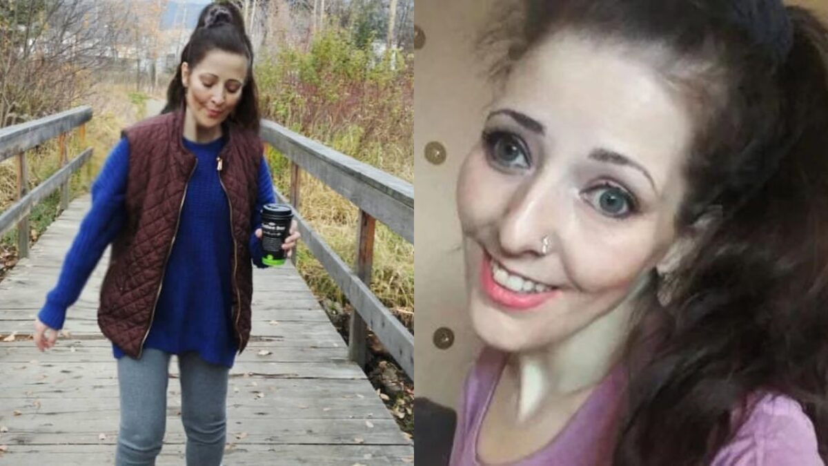 Kelly Ronahan: Amputation und ihre ganze Geschichte erklärt
